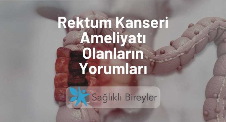 Rektum Kanseri Ameliyatı Olanların Yorumları - Sağlıklı Bireyler